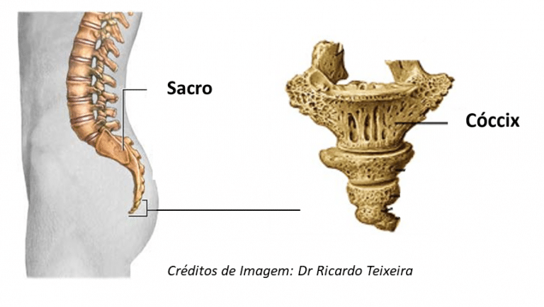 Dor no Cóccix - Coccidínia: Quais são suas causas e tratamentos?