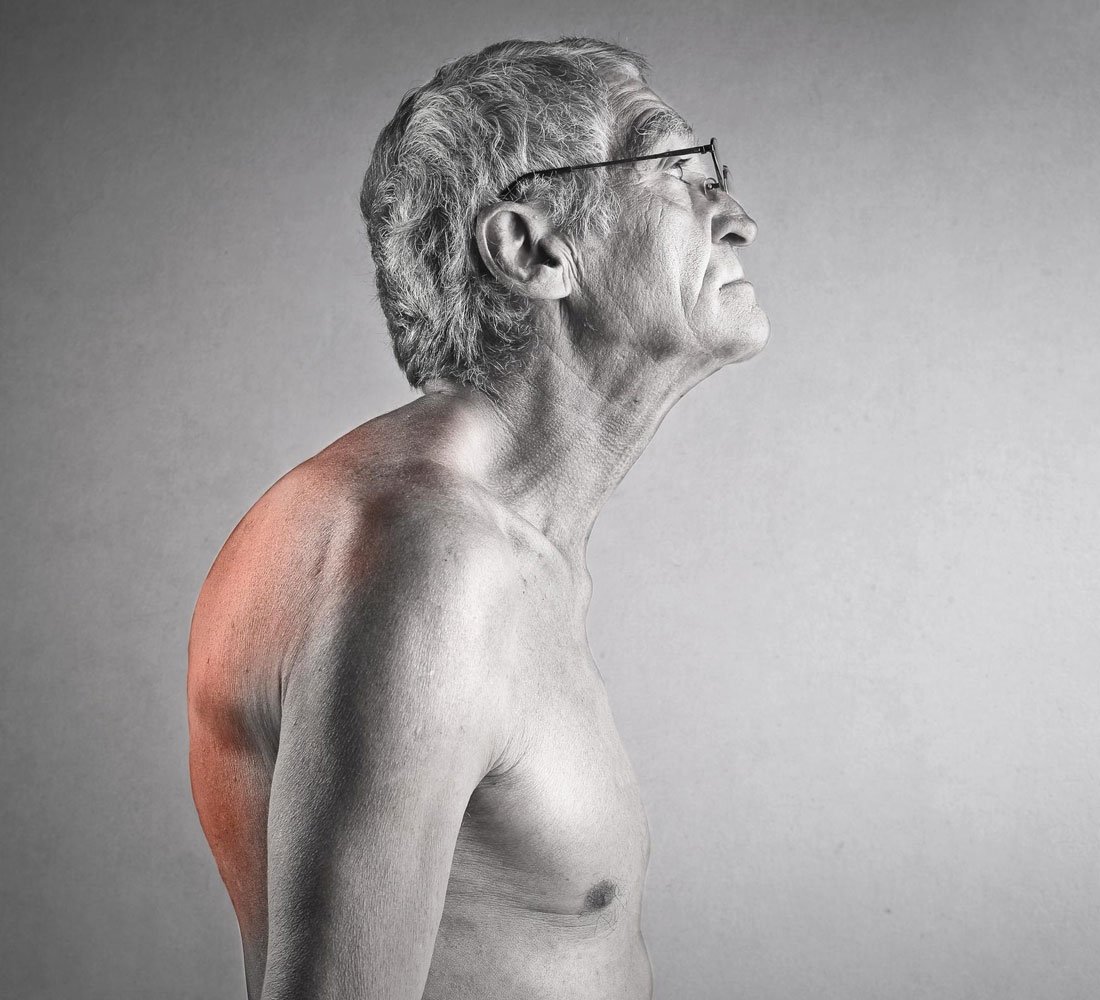 Dor no Cóccix - Coccidínia: Sintomas e Tratamento